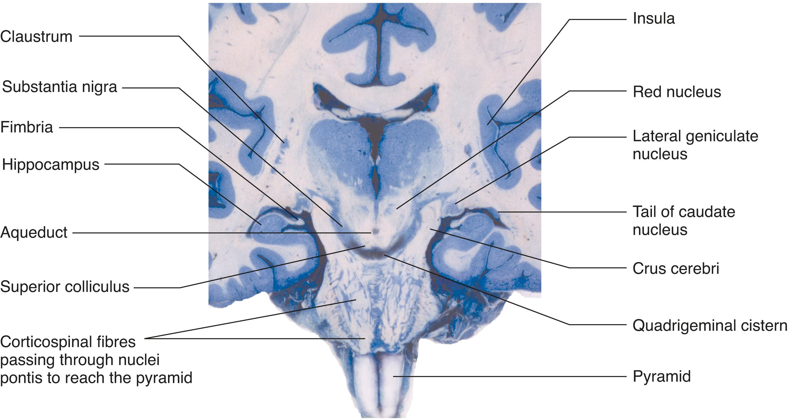 Spinal Cord: Descending Pathways - Clinical Tree