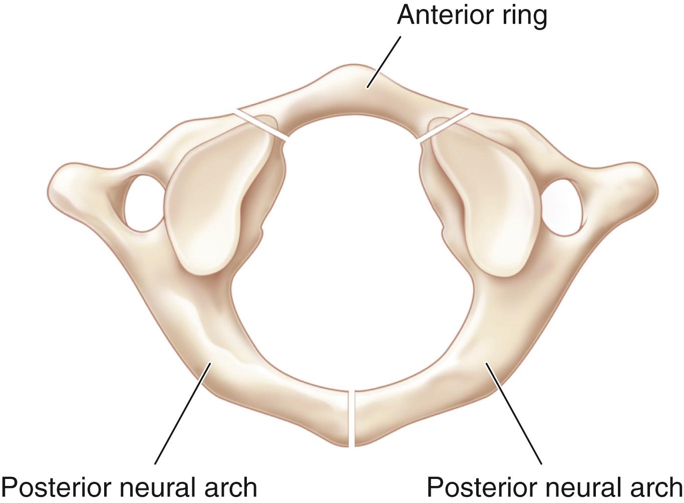 Spinal Injuries - Clinical Tree