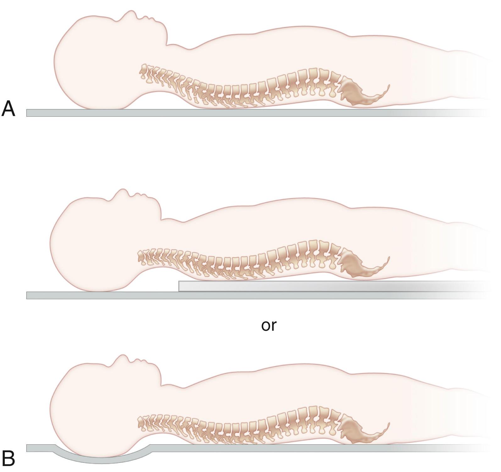 Spinal Injuries - Clinical Tree