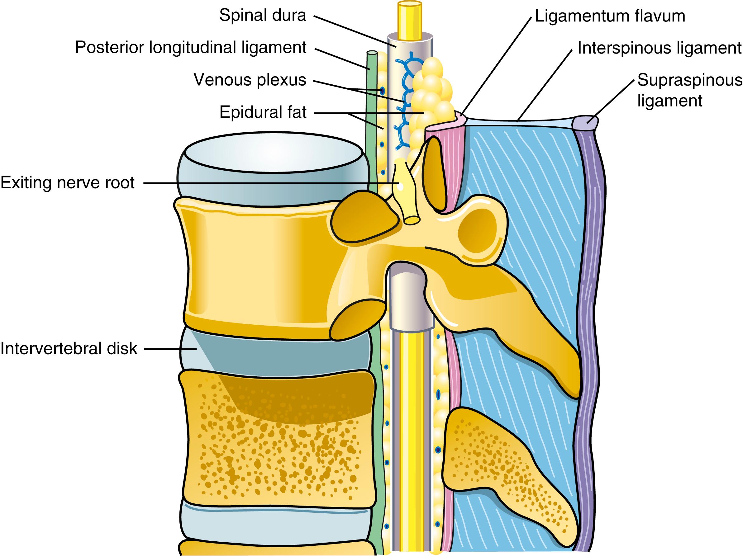 Spine Injections - Clinical Tree