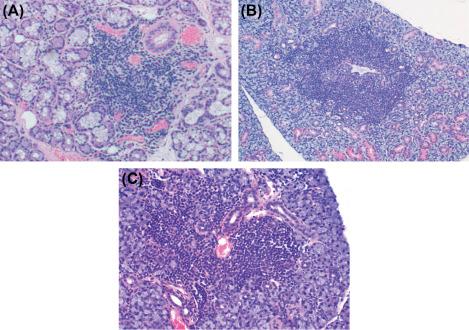 Spontaneous and Inducible Animal Models of Sjögren’s Syndrome ...