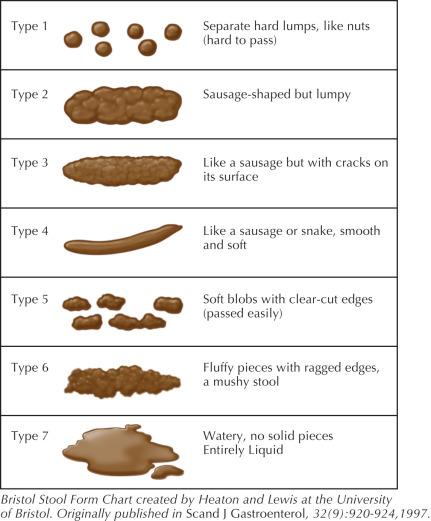 Stool Examination - Clinical Tree