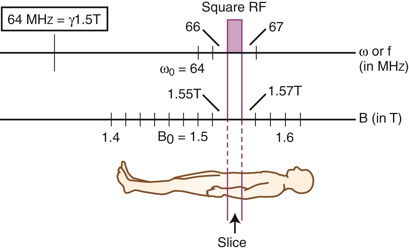 Structural Imaging Using Magnetic Resonance Imaging and Computed ...