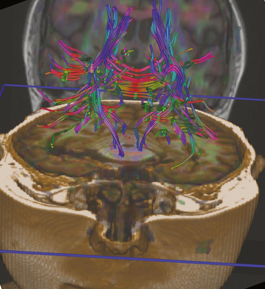 Structural Imaging Using Magnetic Resonance Imaging and Computed ...