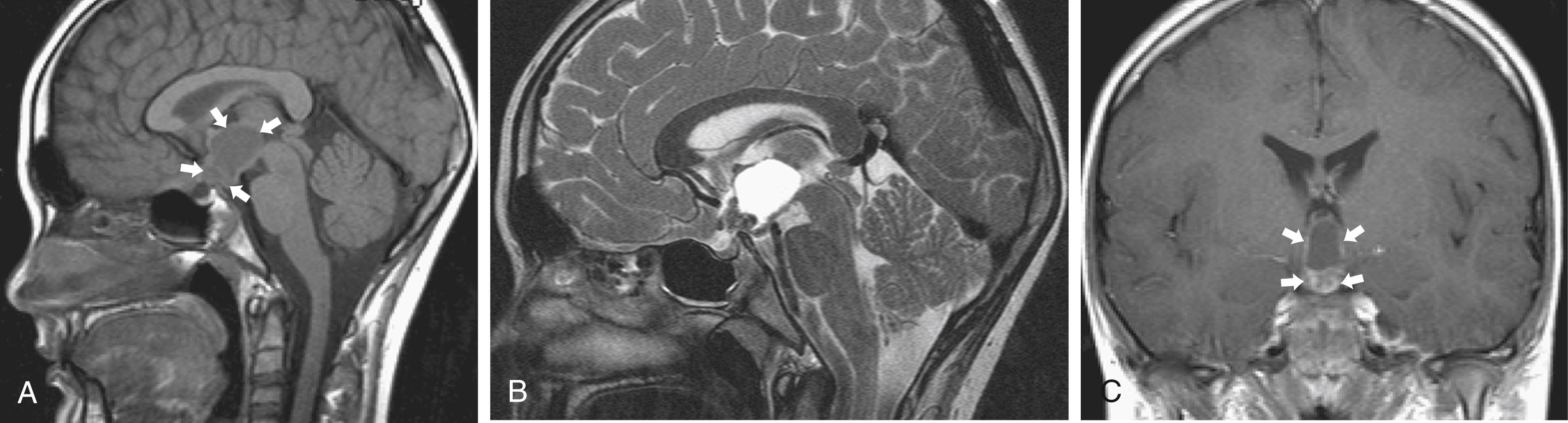 Structural Imaging Using Magnetic Resonance Imaging and Computed ...