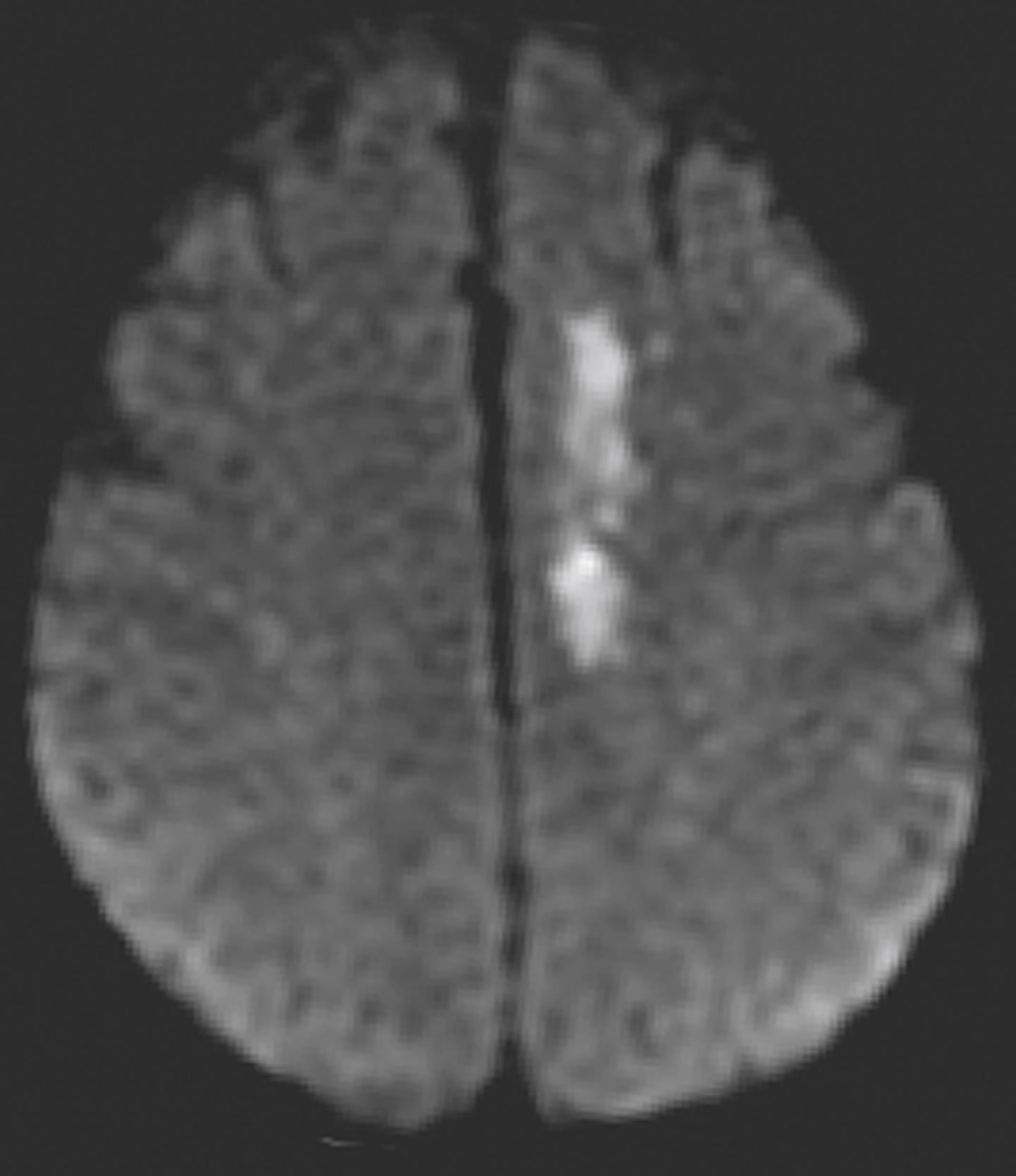 Structural Imaging Using Magnetic Resonance Imaging and Computed ...