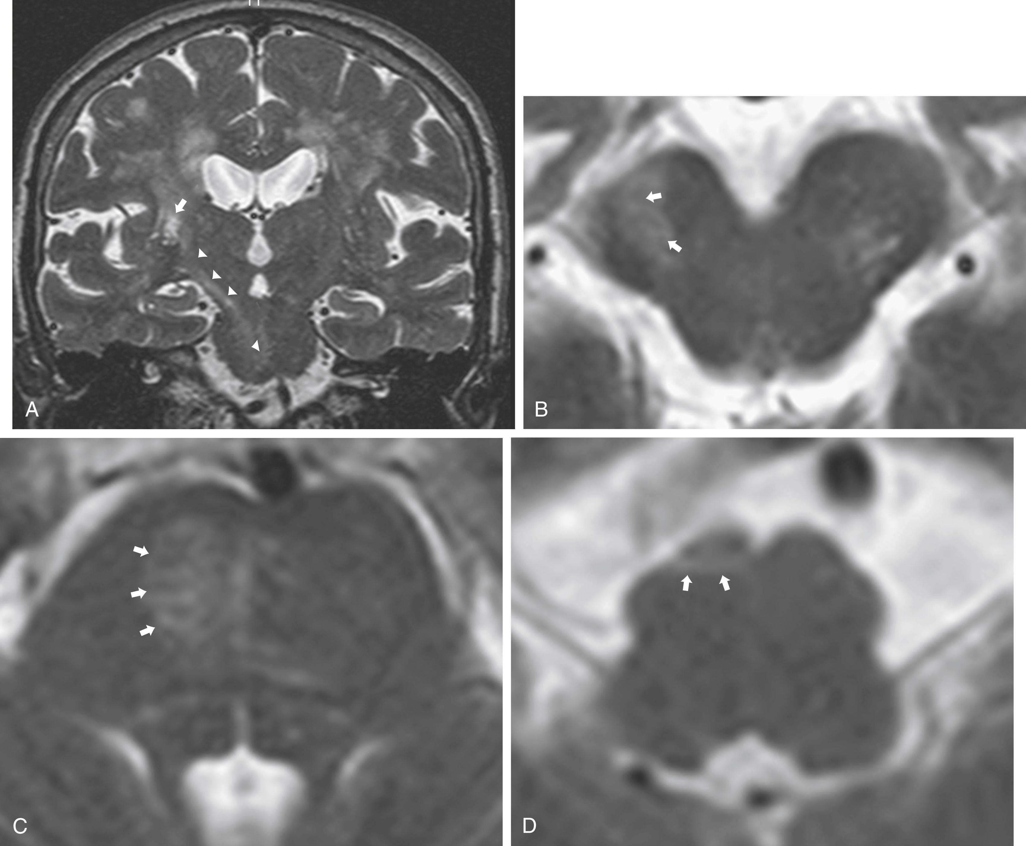 Structural Imaging Using Magnetic Resonance Imaging and Computed ...