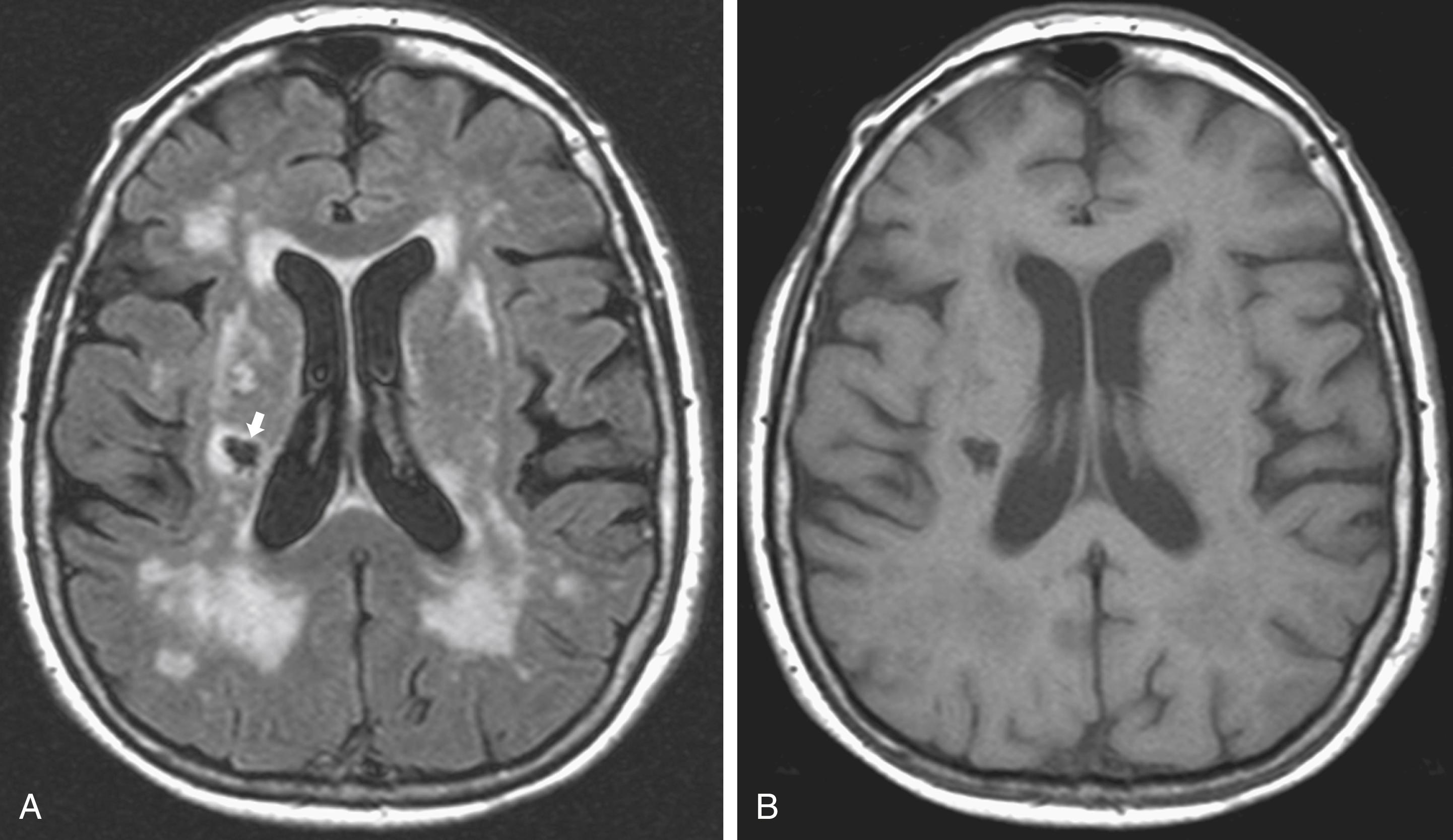 Structural Imaging Using Magnetic Resonance Imaging and Computed ...