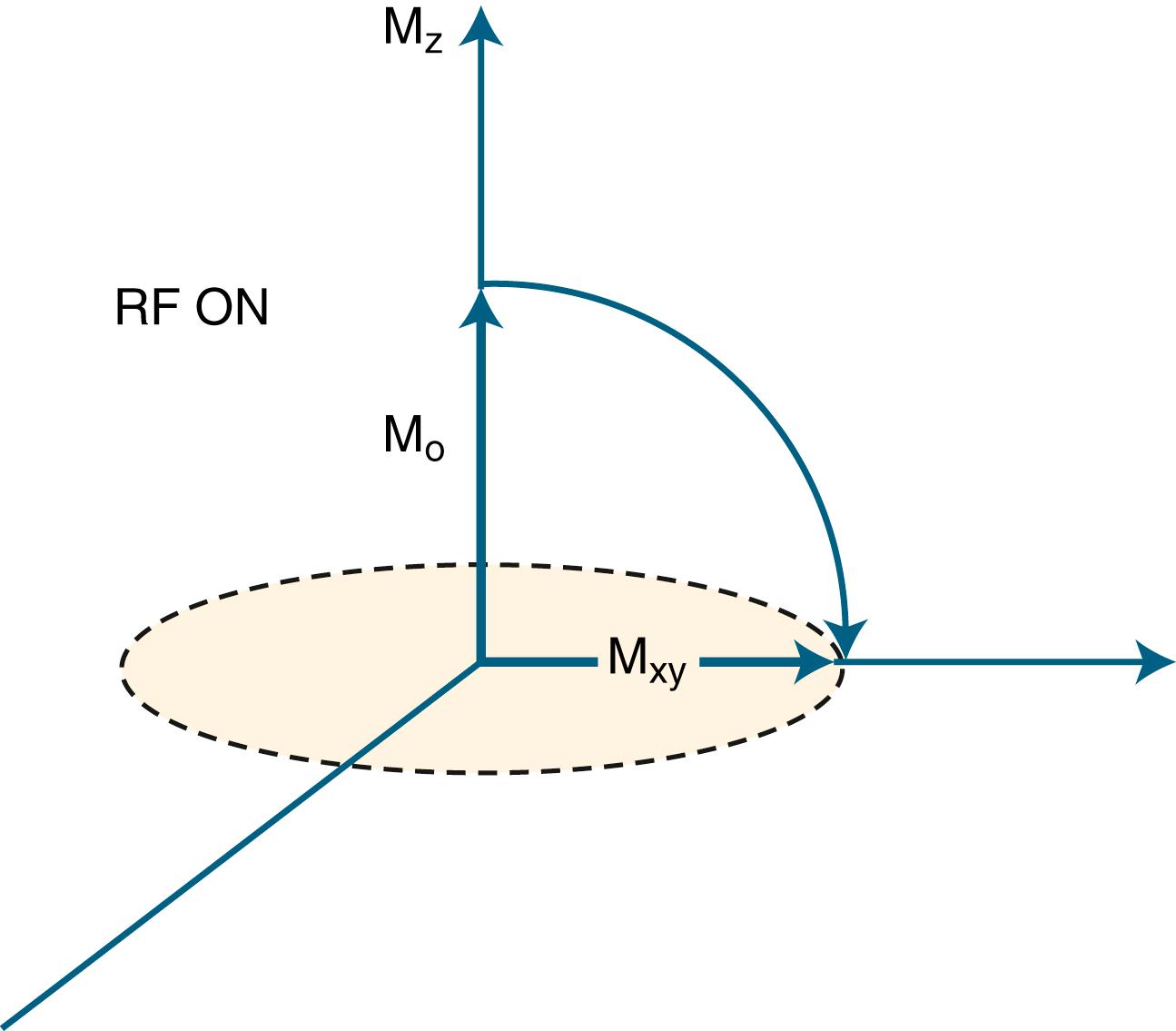 Structural Imaging Using Magnetic Resonance Imaging and Computed ...