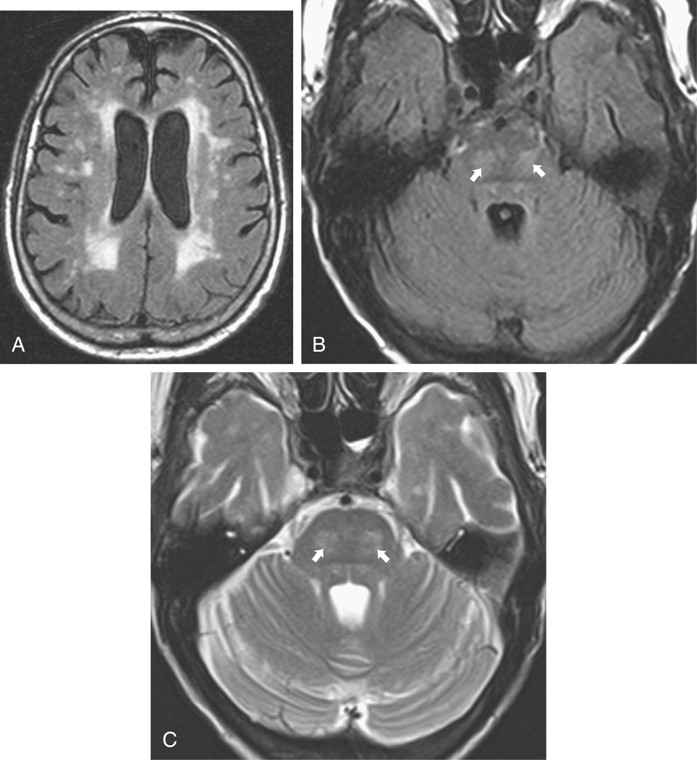 Structural Imaging Using Magnetic Resonance Imaging and Computed ...