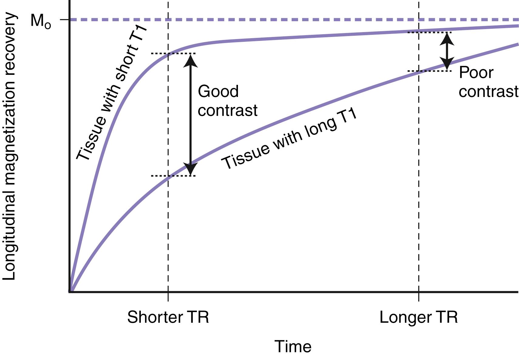 Structural Imaging Using Magnetic Resonance Imaging and Computed ...