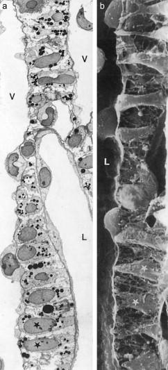Structural Organization of the Mammalian Kidney - Clinical Tree