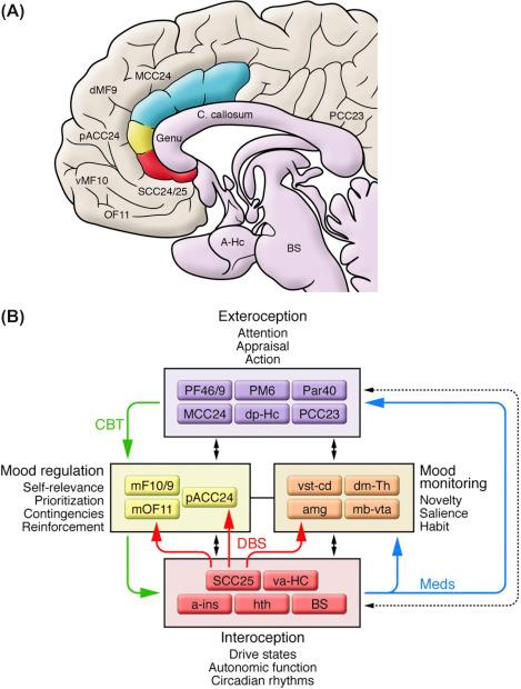 Subgenual Cingulate Deep Brain Stimulation for Treatment-Resistant ...