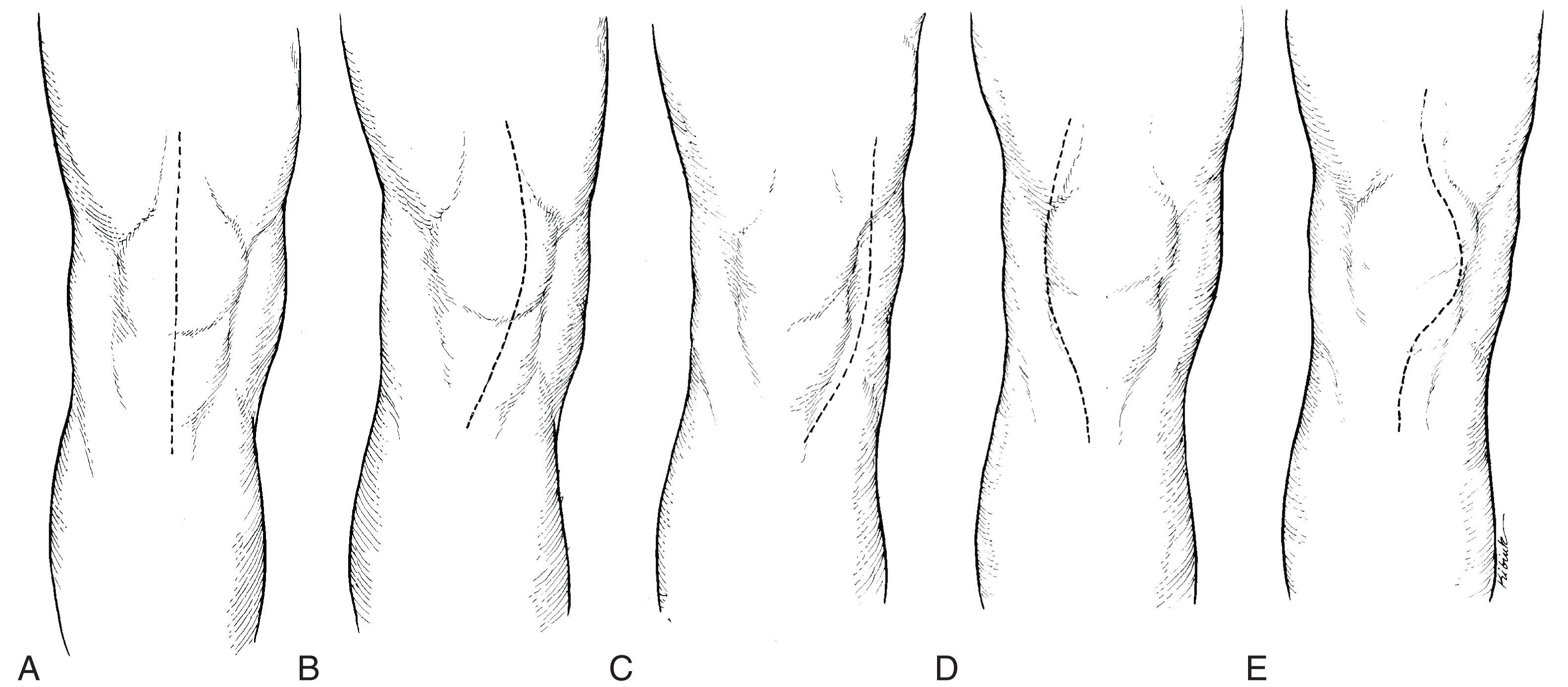 Surgical Procedure - Clinical Tree