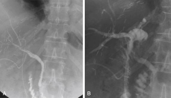 Technical Problems: Biliary - Clinical Tree
