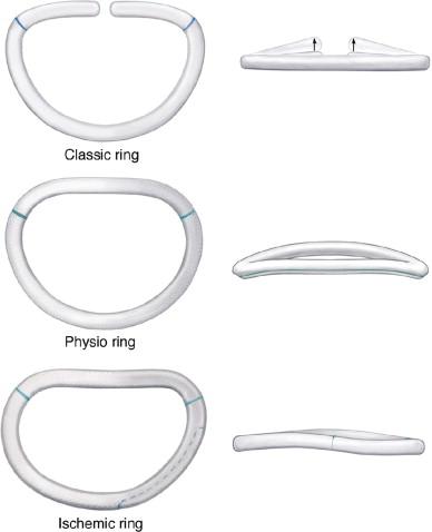 Techniques in Type I Dysfunction - Clinical Tree