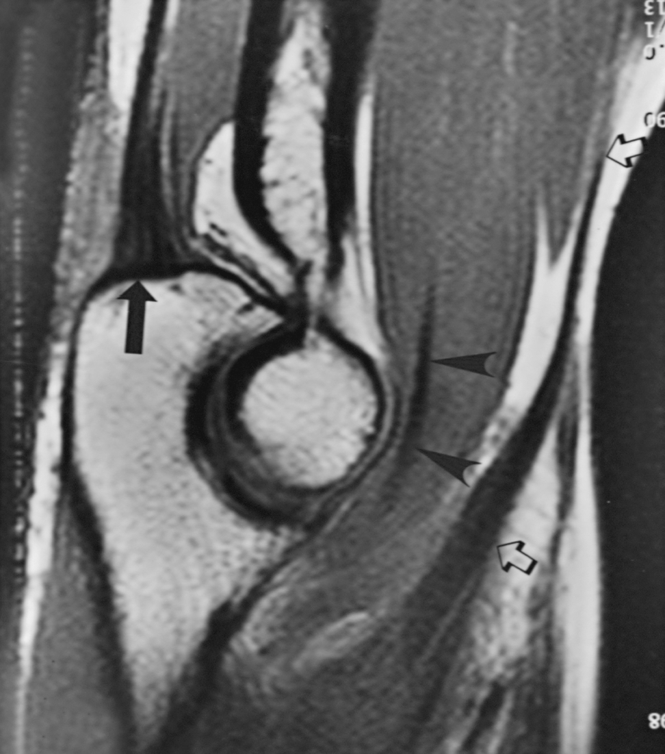 Tendons and Muscles - Clinical Tree