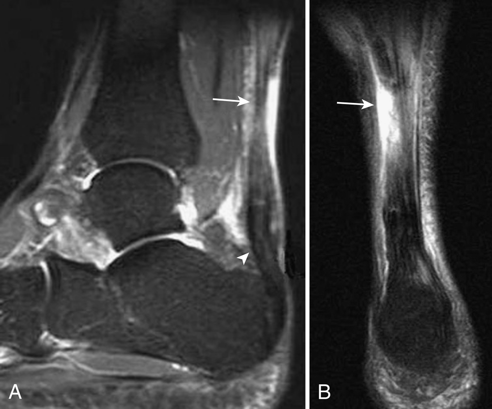 Tendons and Muscles - Clinical Tree