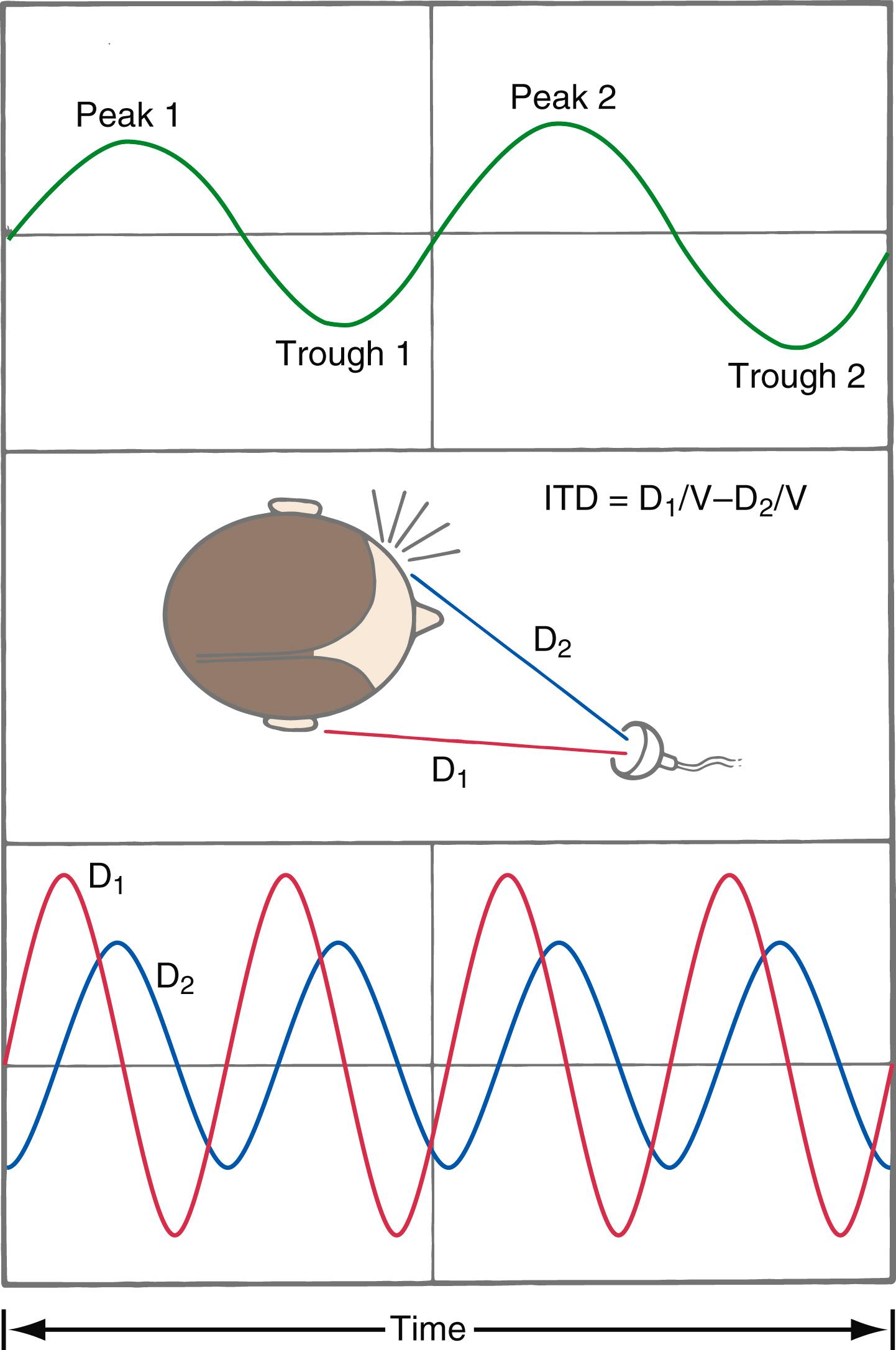The Auditory System - Clinical Tree