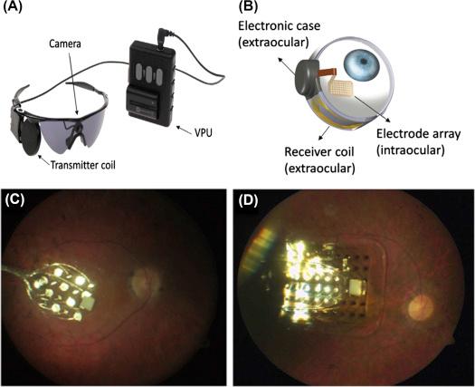 The Development of Visual Prosthetic Devices to Restore Vision to the ...