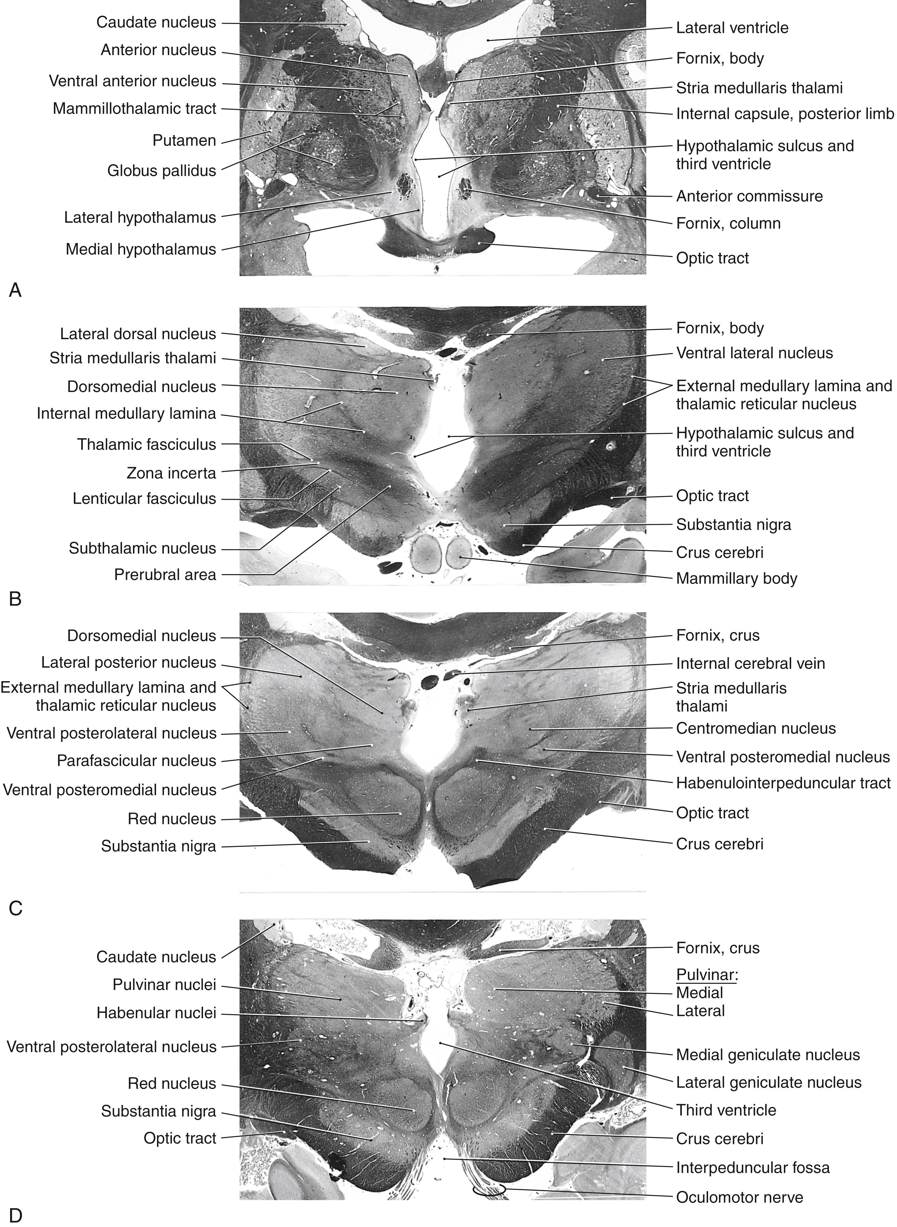 The Diencephalon - Clinical Tree