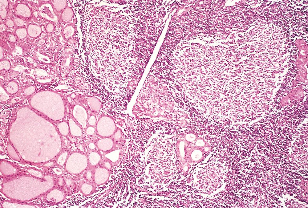The Endocrine System - Clinical Tree