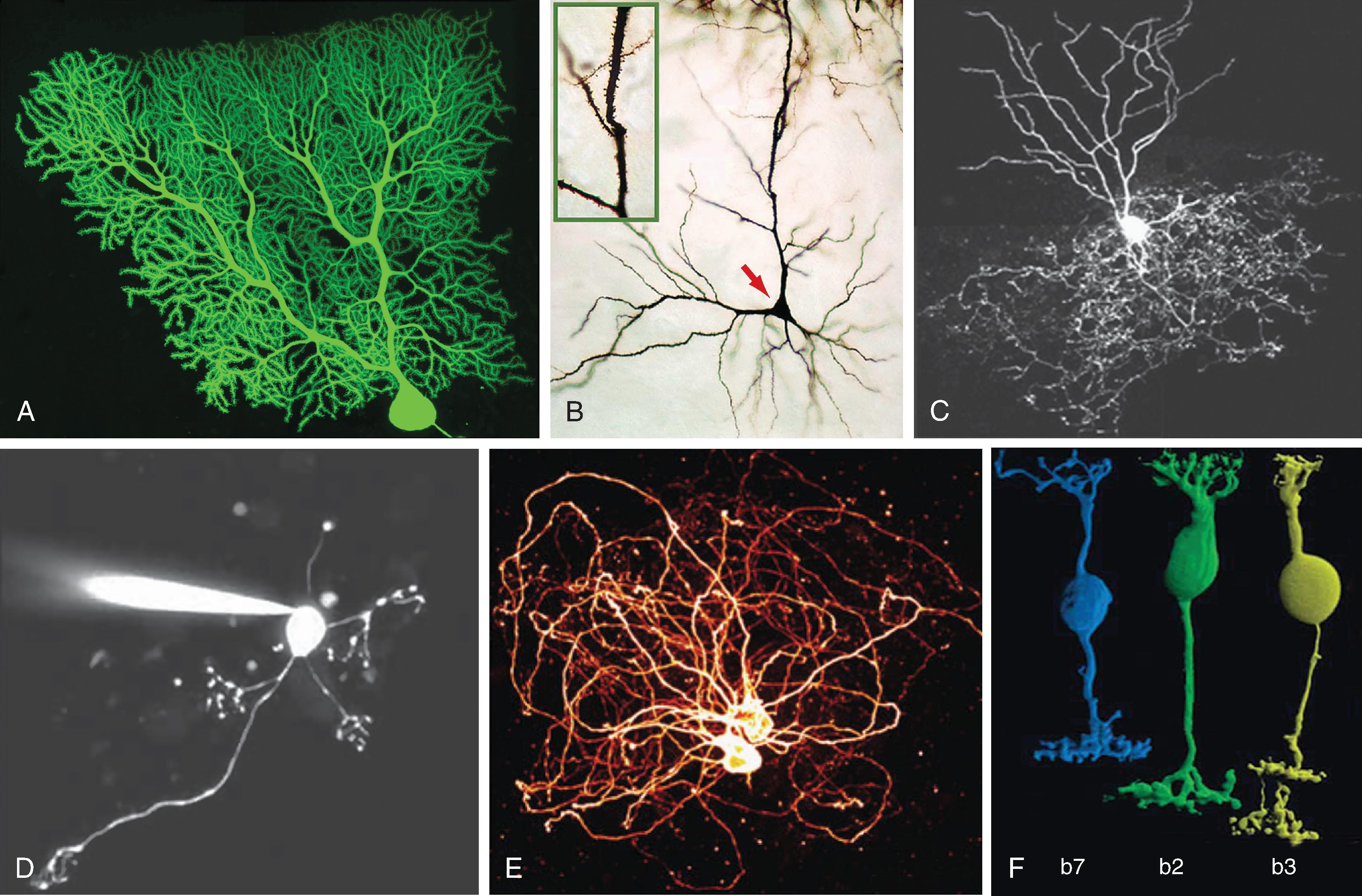 The Nervous System: Introduction to Cells and Systems - Clinical Tree