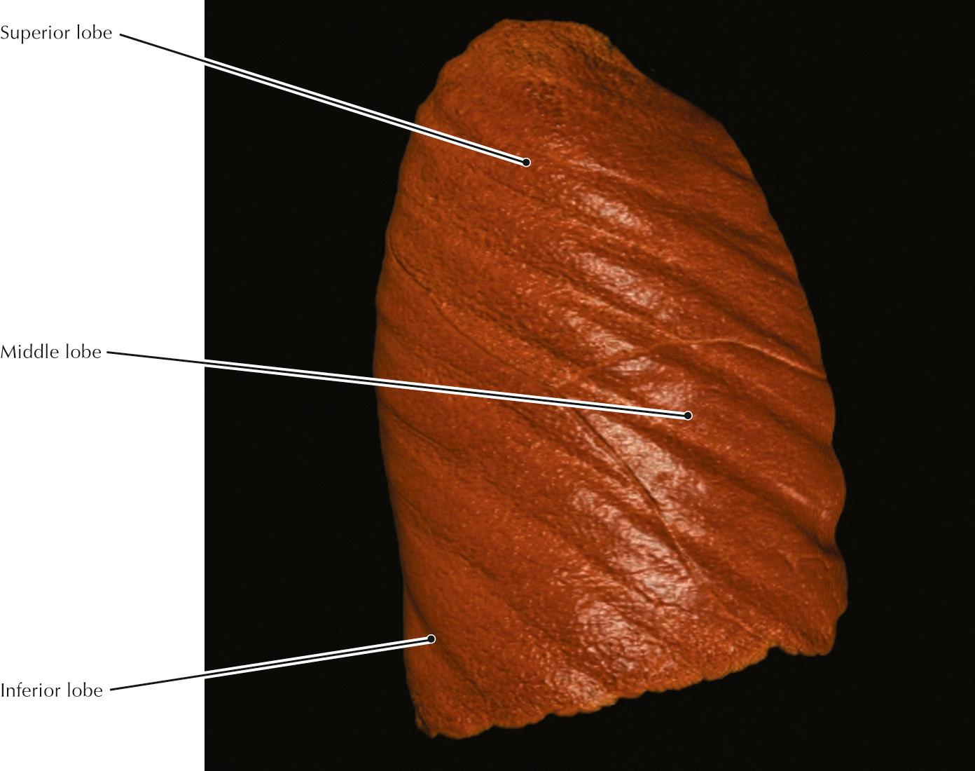 Thorax - Clinical Tree