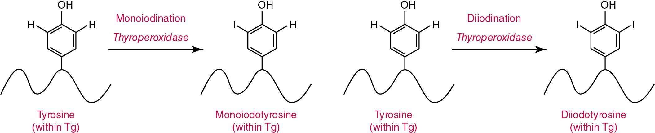 Thyroid disorders - Clinical Tree