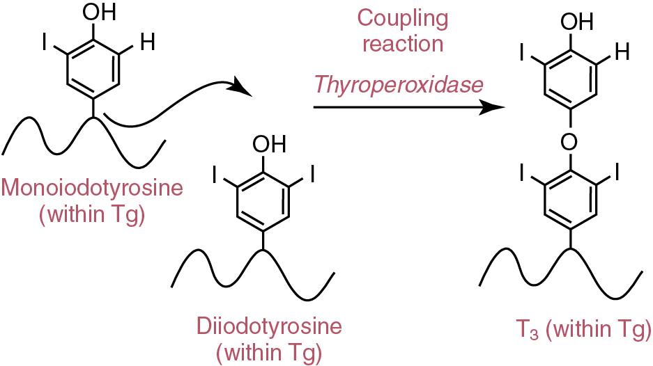 Thyroid disorders - Clinical Tree