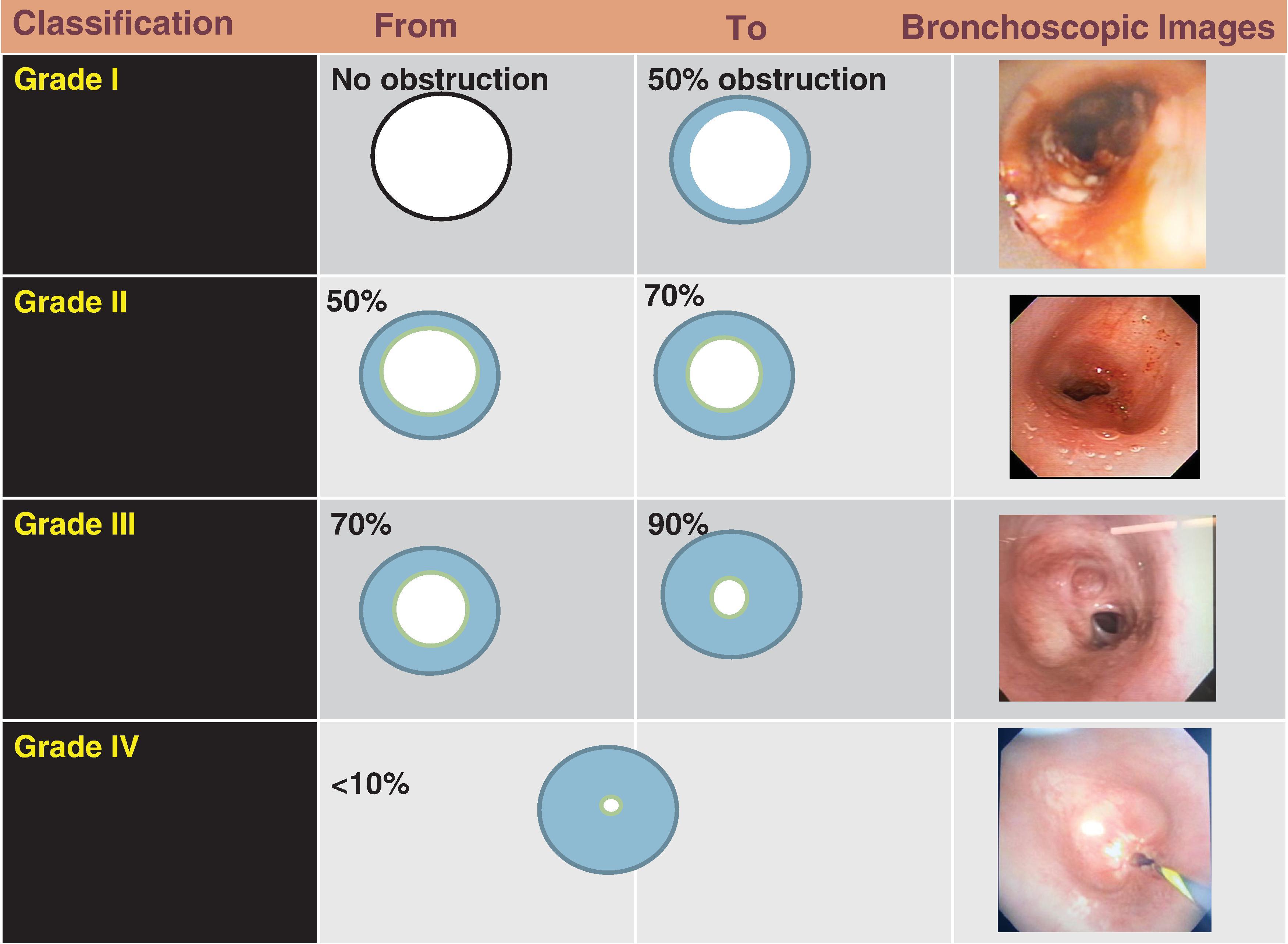 Tracheal Resection and Reconstruction - Clinical Tree