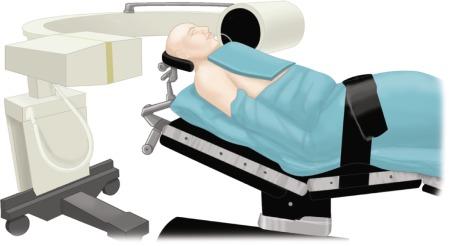 Transcallosal Approach - Clinical Tree