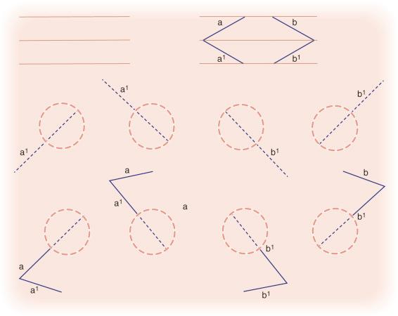 Transposition Flaps - Clinical Tree