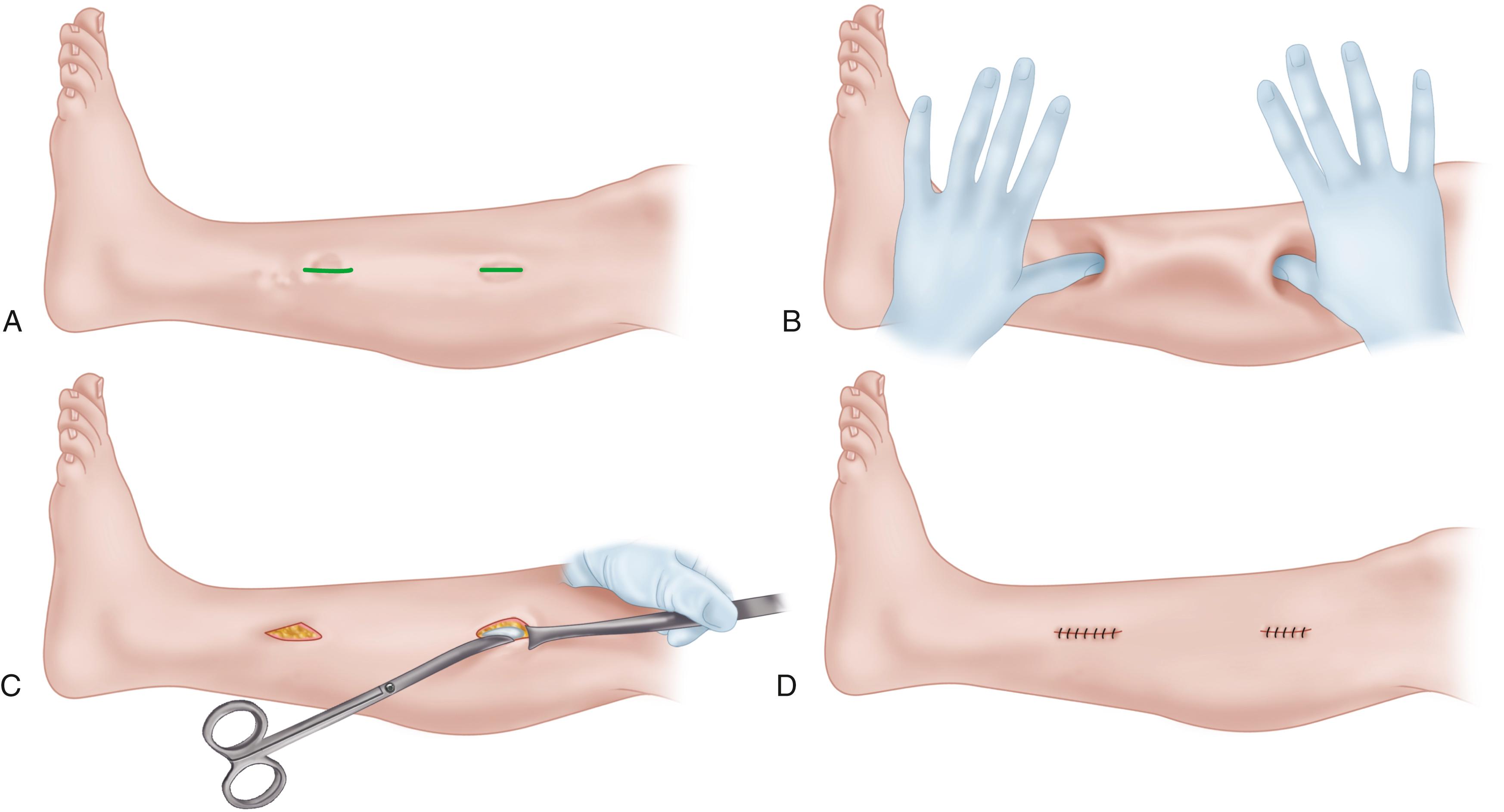 Traumatic Disorders - Clinical Tree
