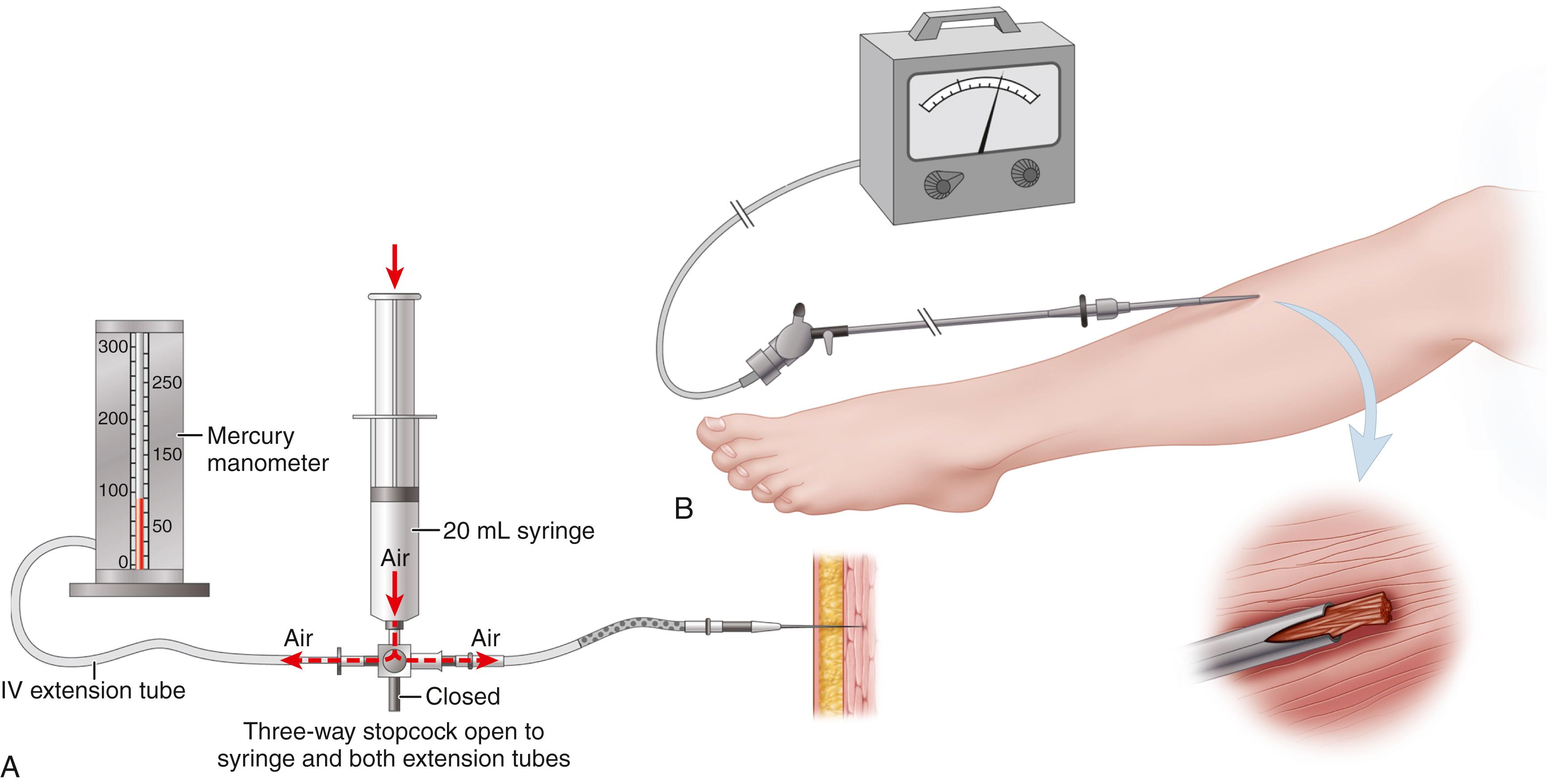 Traumatic Disorders - Clinical Tree