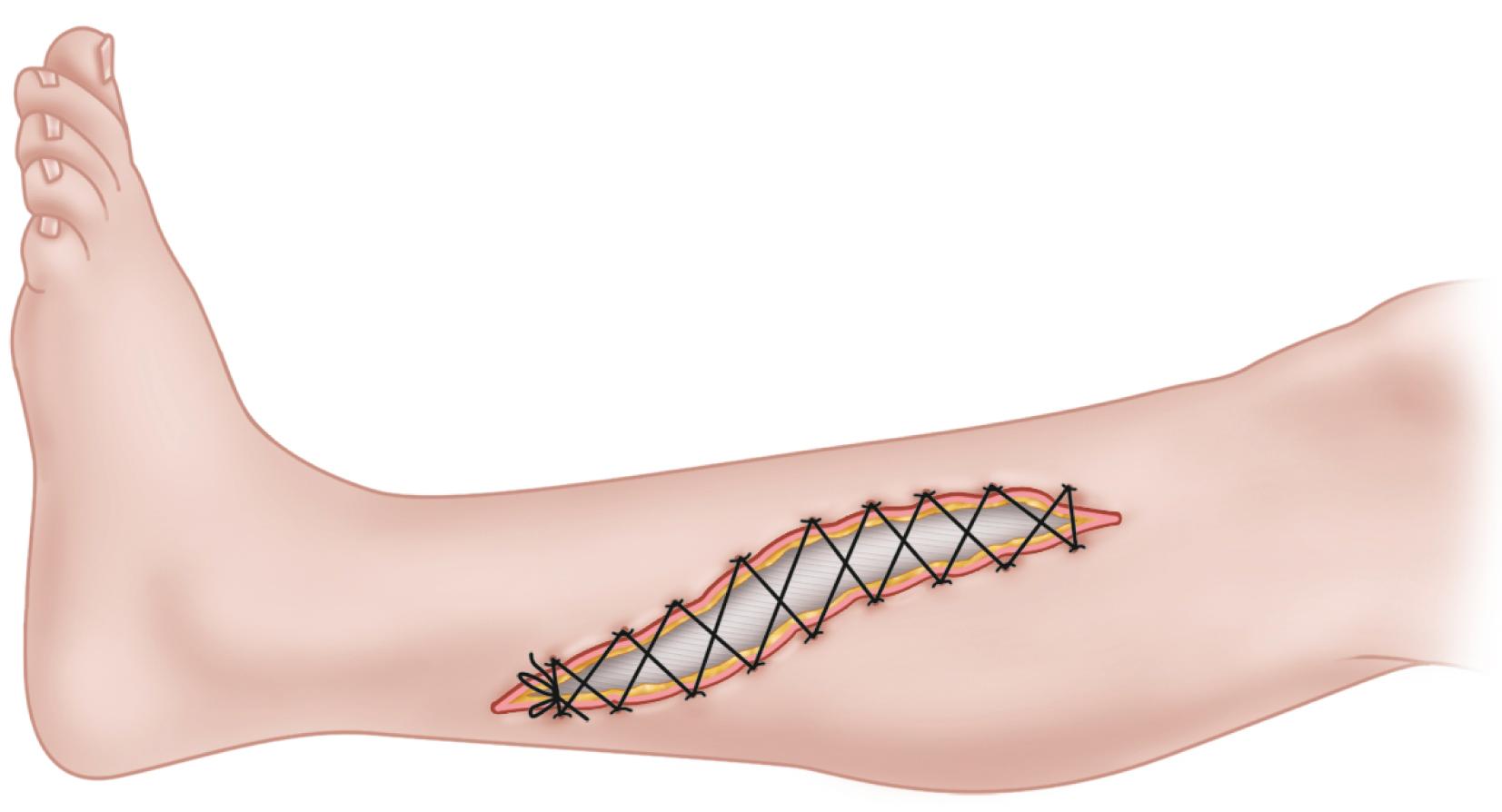 Traumatic Disorders - Clinical Tree
