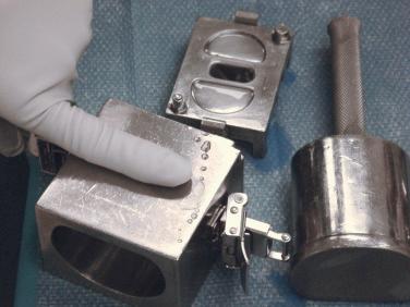 Two-Stage Revision - Clinical Tree