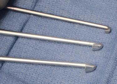 Two-Stage Revision Total Hip Arthroplasty - Clinical Tree