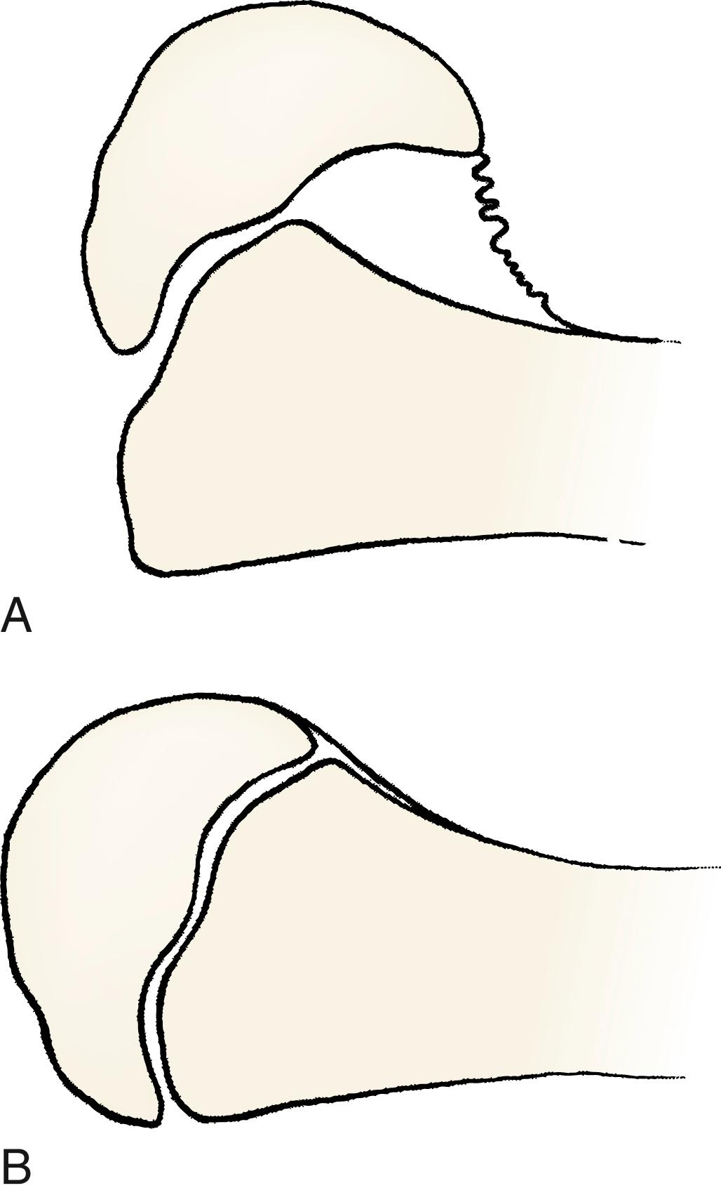 Upper Extremity Injuries - Clinical Tree