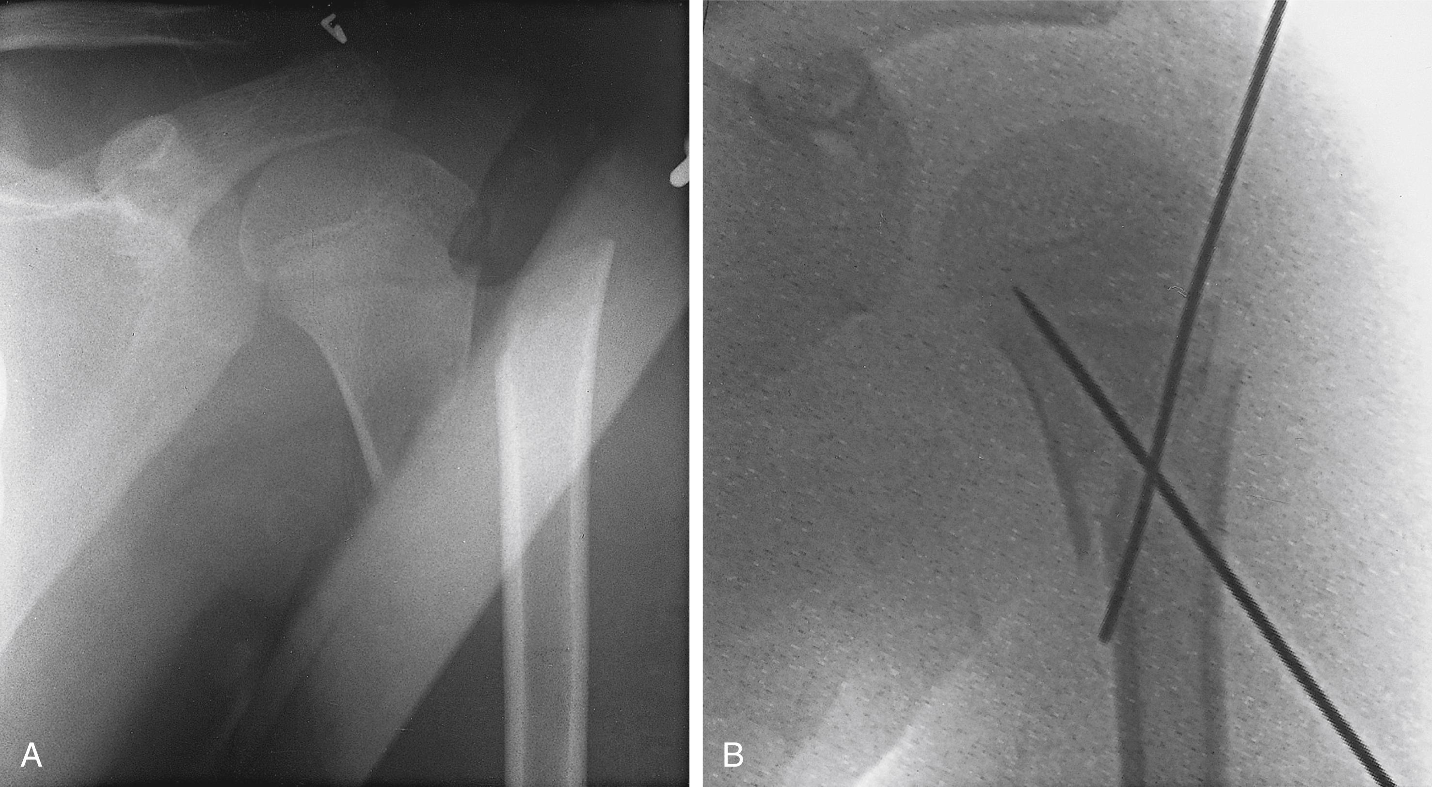 Upper Extremity Injuries - Clinical Tree