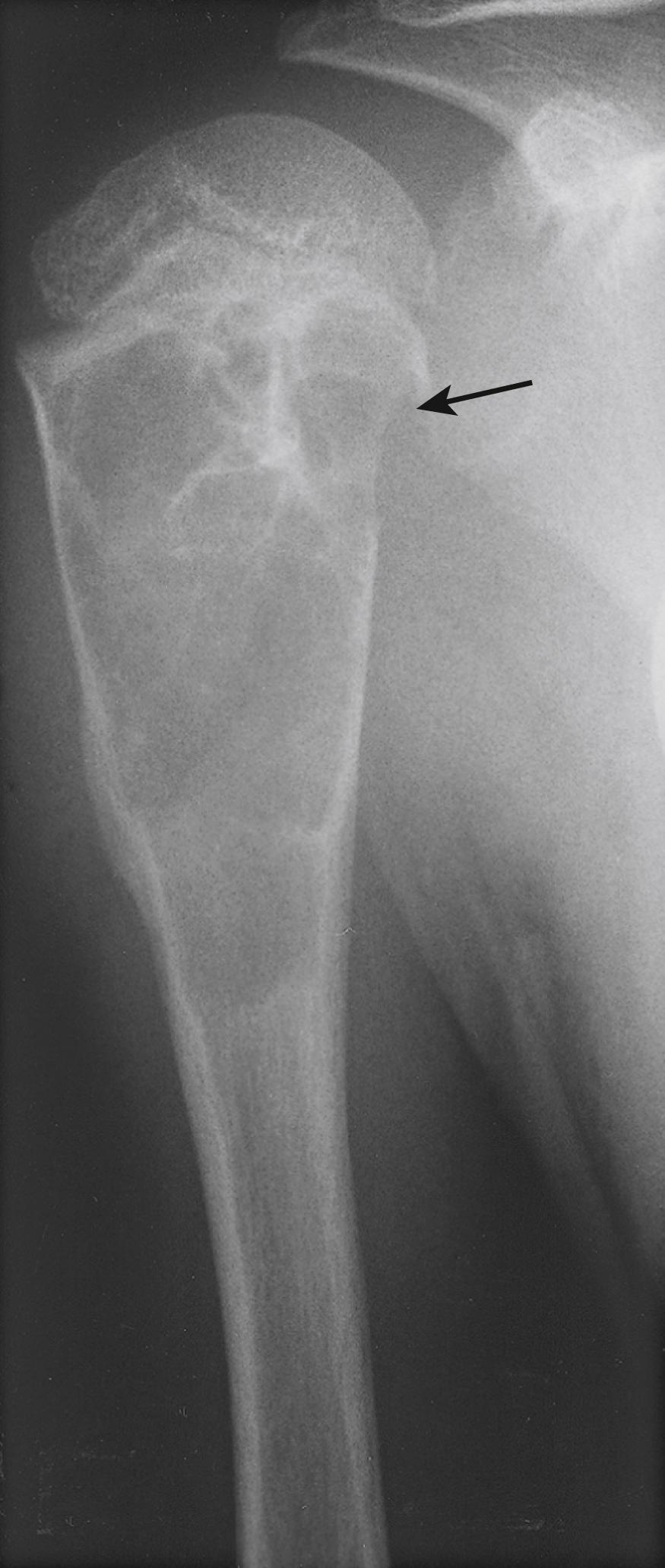 Upper Extremity Injuries - Clinical Tree