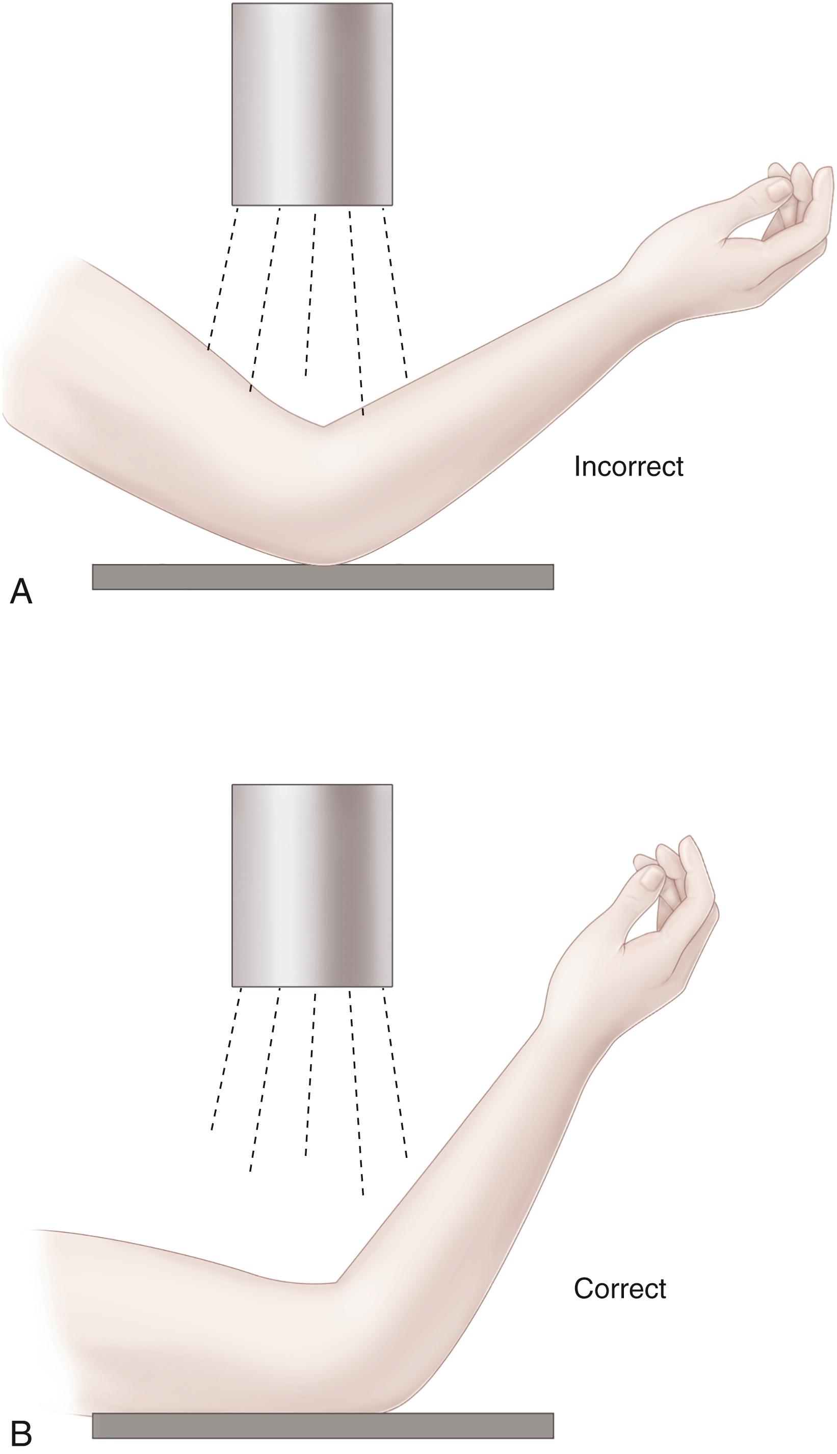 Upper Extremity Injuries - Clinical Tree