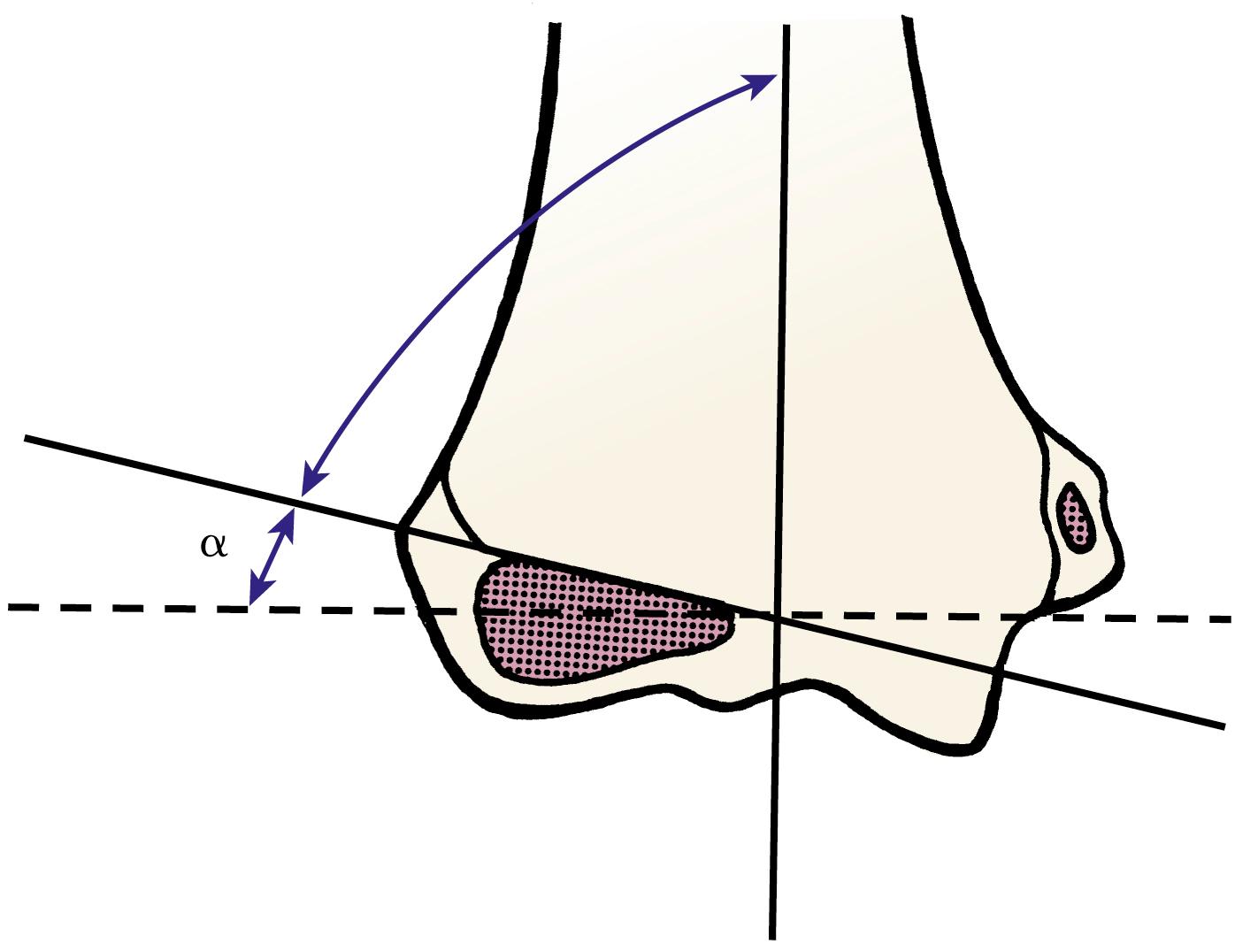 Upper Extremity Injuries - Clinical Tree