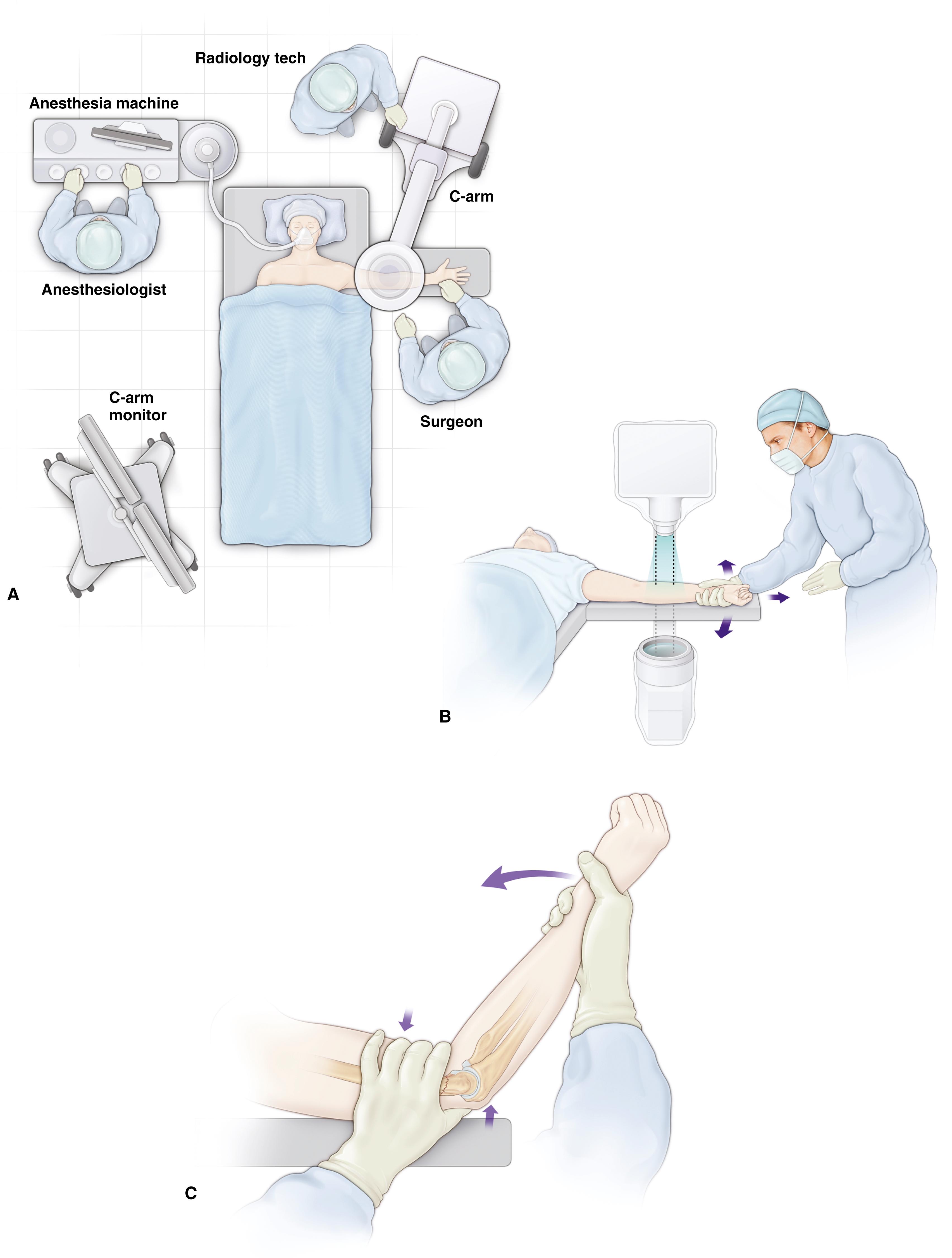 Upper Extremity Injuries - Clinical Tree