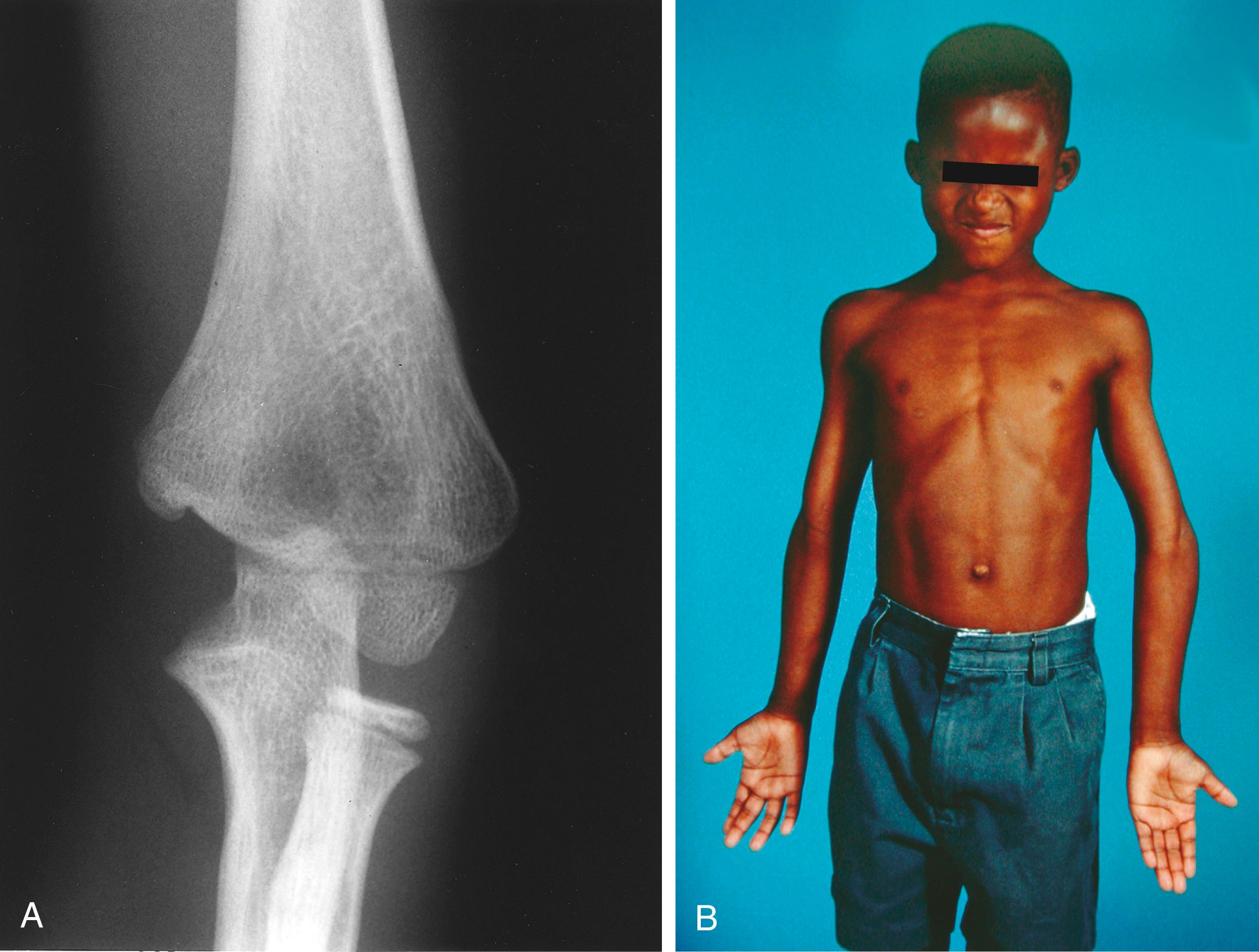 Upper Extremity Injuries - Clinical Tree