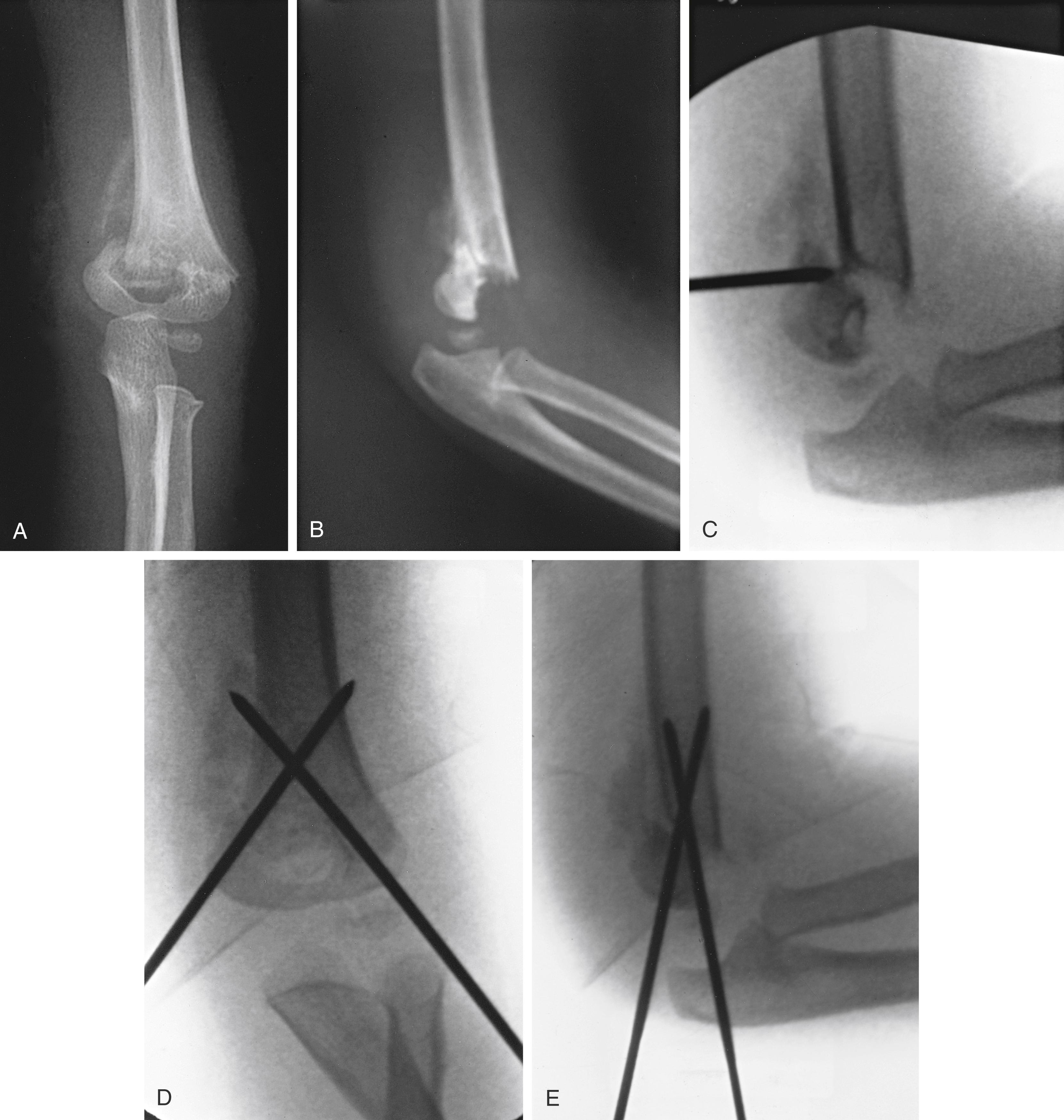 Upper Extremity Injuries - Clinical Tree