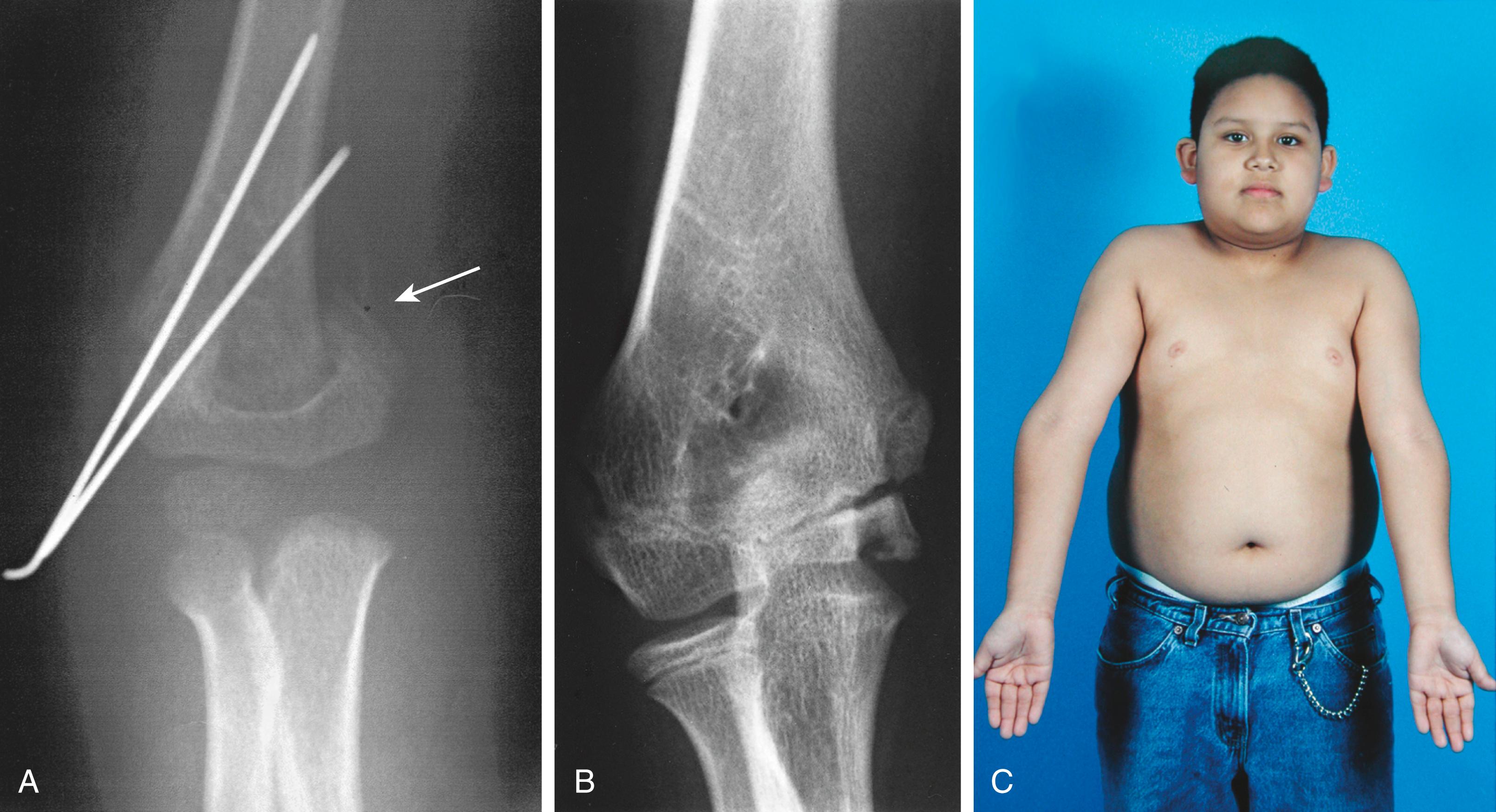 Upper Extremity Injuries - Clinical Tree