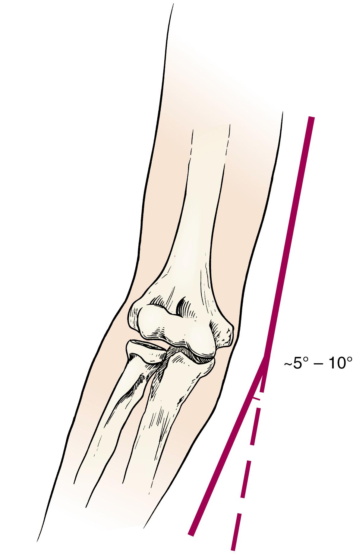 Upper Extremity Injuries - Clinical Tree