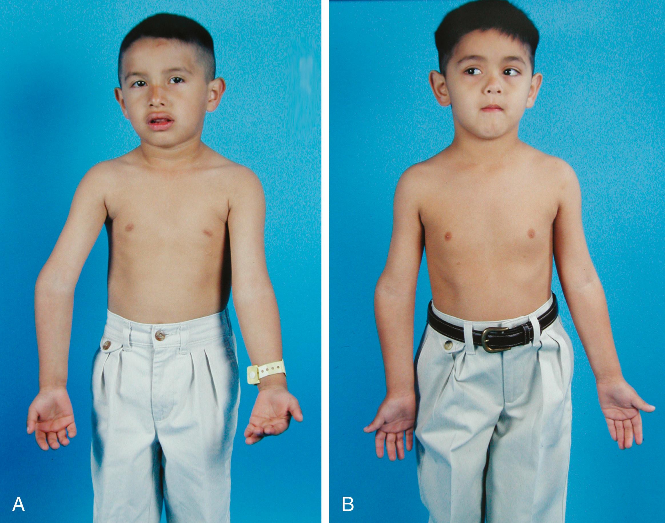 Upper Extremity Injuries - Clinical Tree