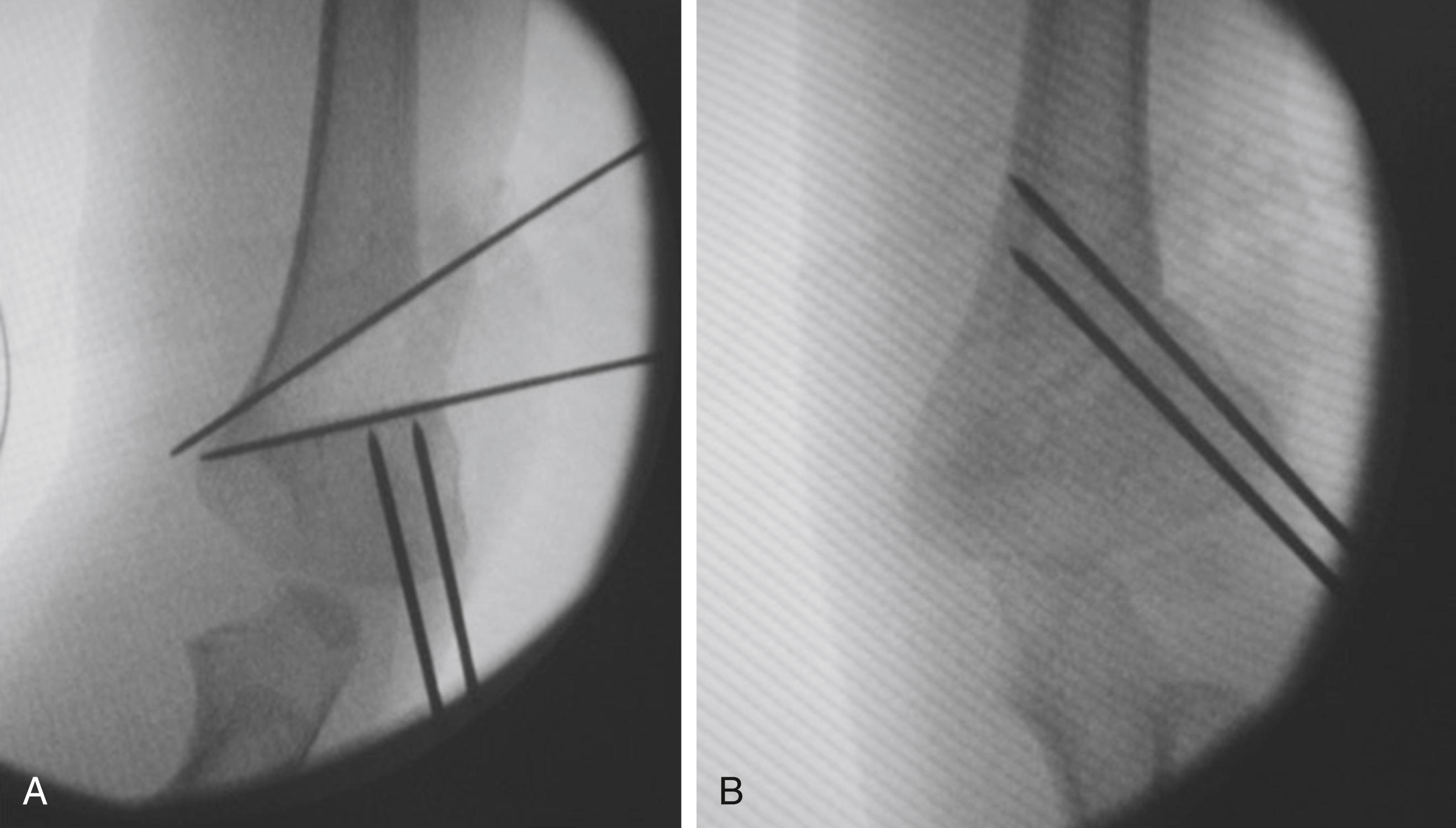 Upper Extremity Injuries - Clinical Tree